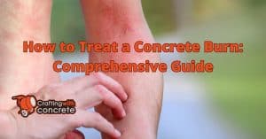 How to treat a concrete burn - craftingwithconcrete.com