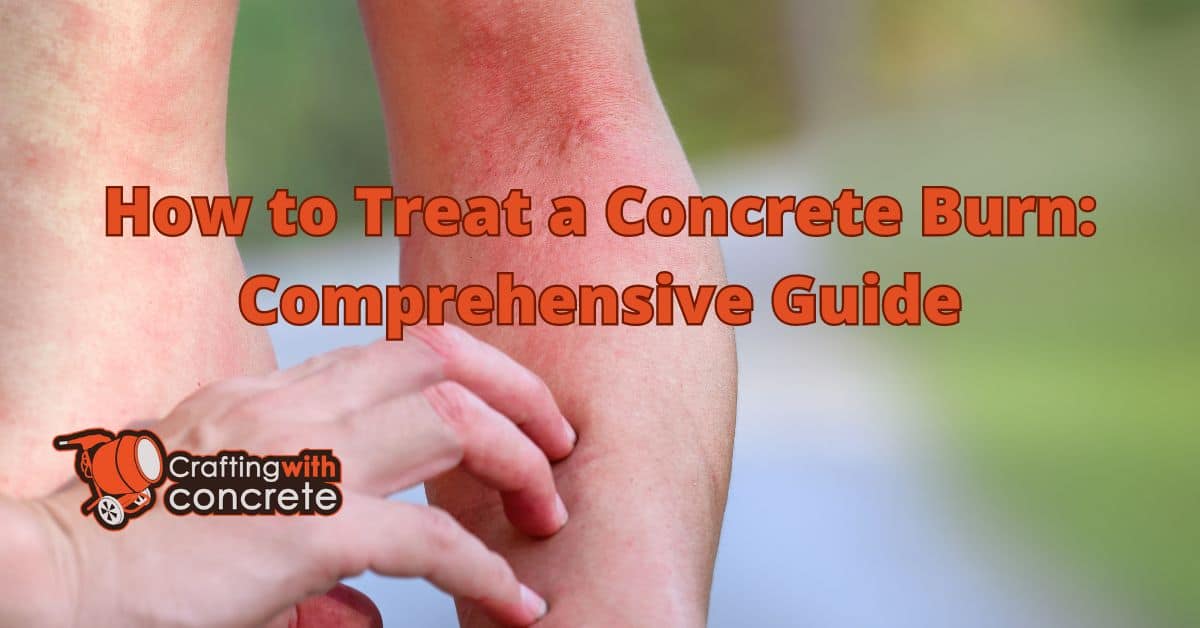 How to treat a concrete burn - craftingwithconcrete.com